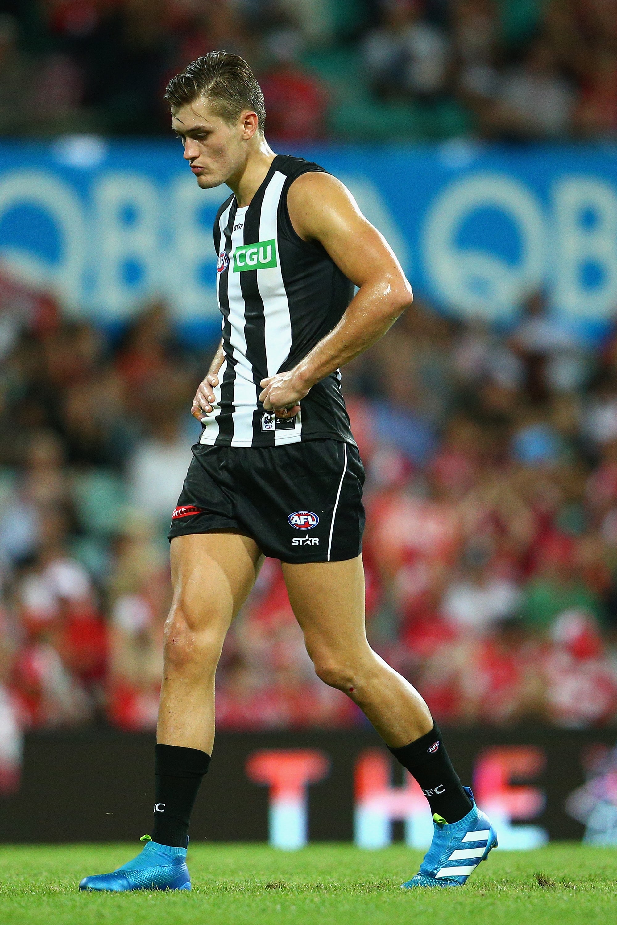 Swan's 'significant' injury means surgery