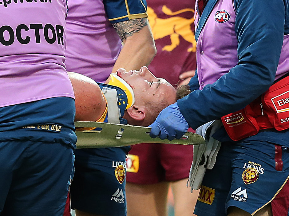 League still searches for clarity on concussion