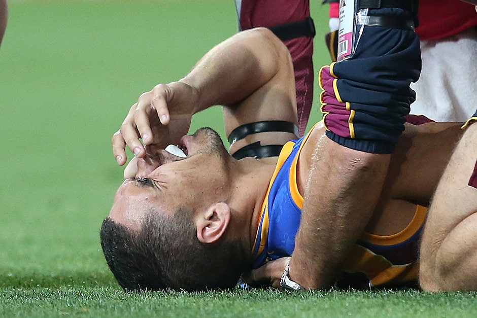 Lion livewire's miraculous recovery after sickening arm injury