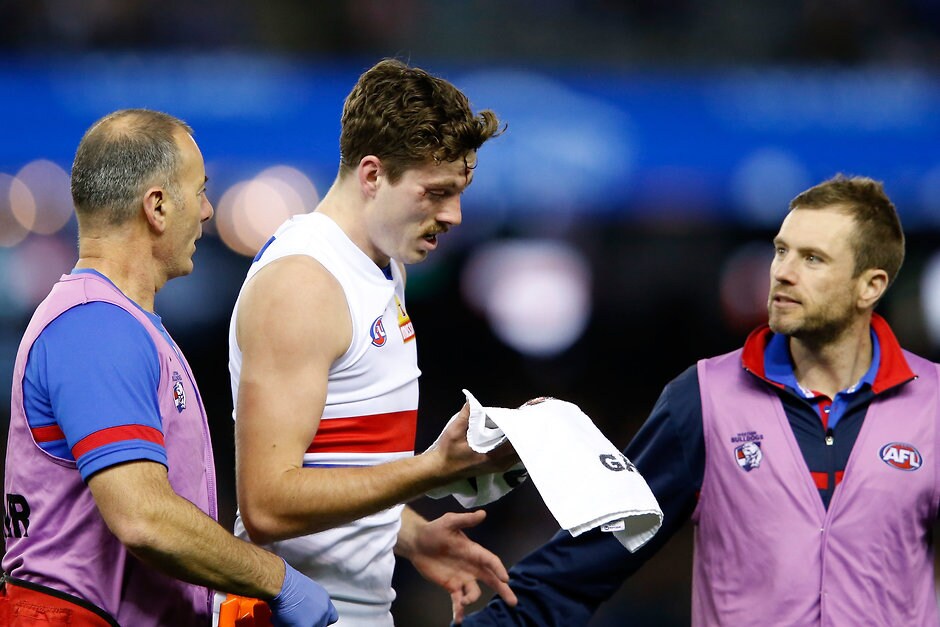 Boot in head sees Cordy's forehead cracked