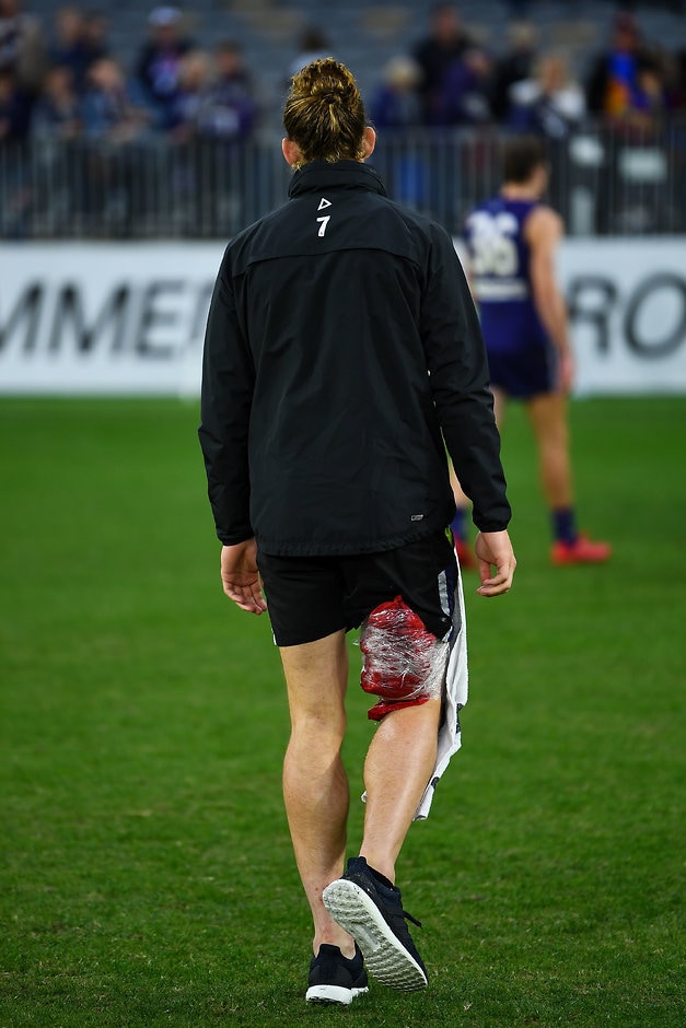 Injury survey: Hamstrings top the charts again