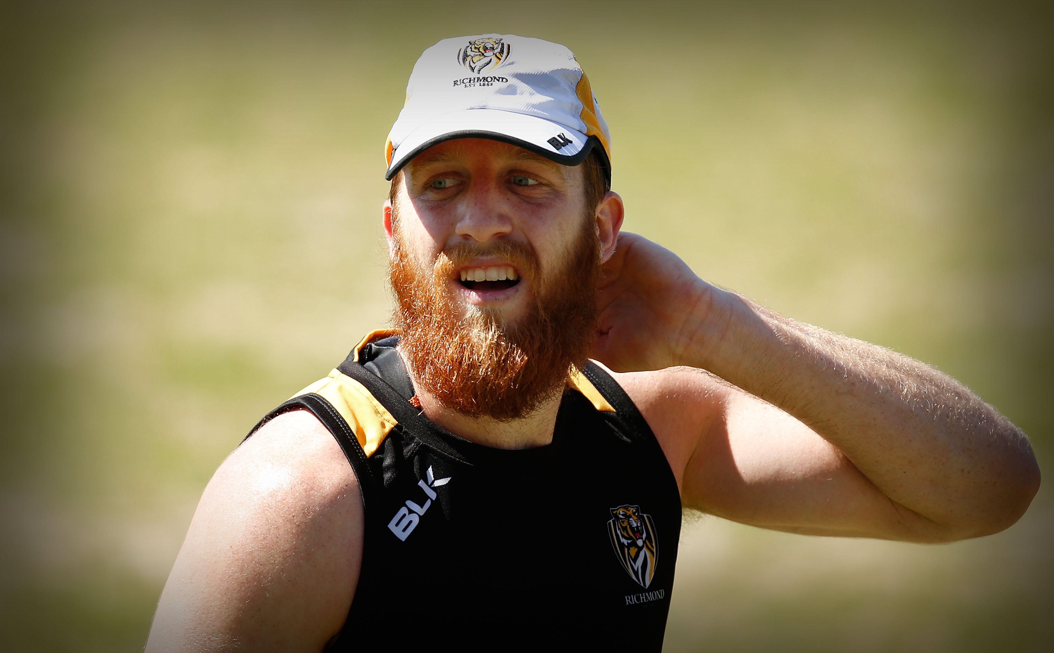 Knee surgery sidelines Tiger Conca