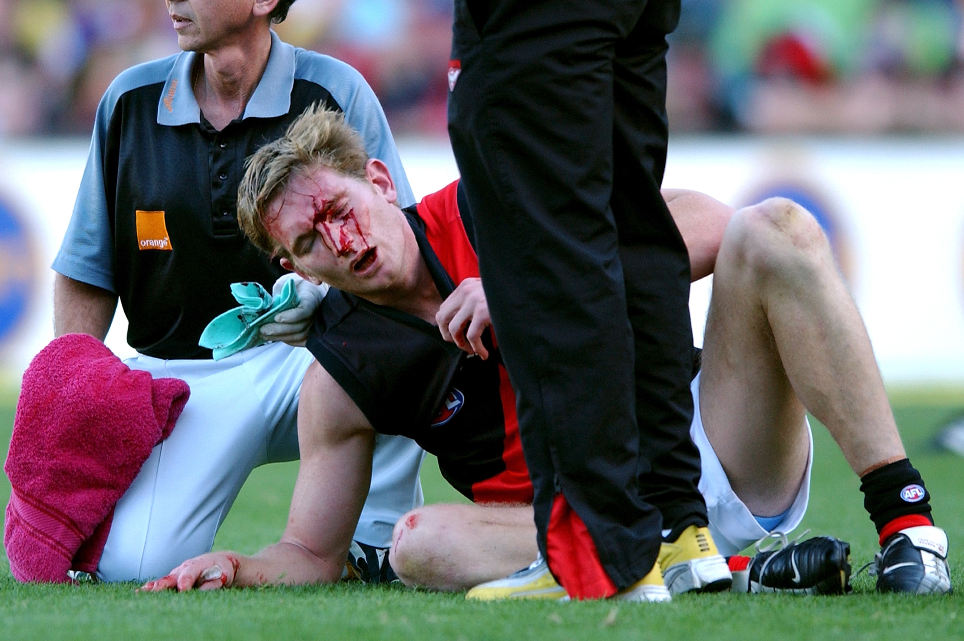 'I was on the ground looking for my teeth and trying to feel my face'