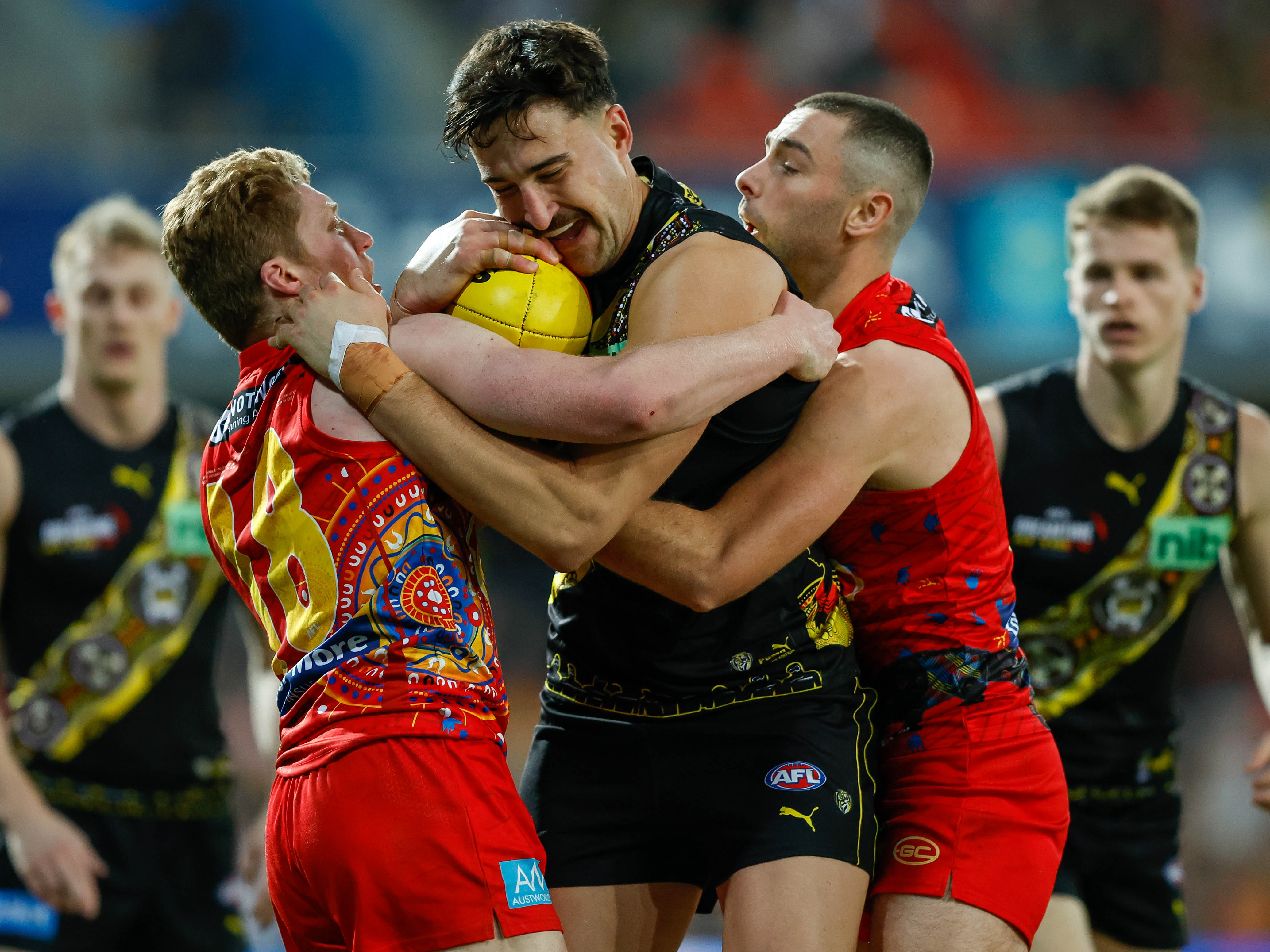 'It's going to be a challenge': Injury carnage as Tigers count cost of ...