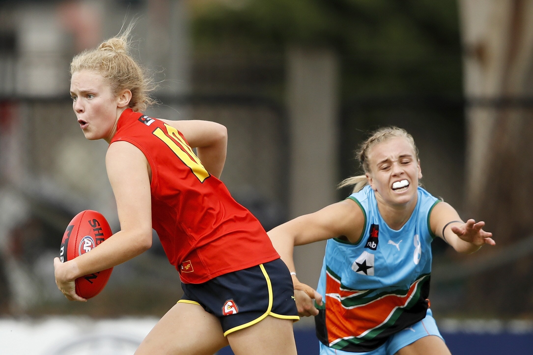 Hit by an out-of-control car … becomes AA ruck star