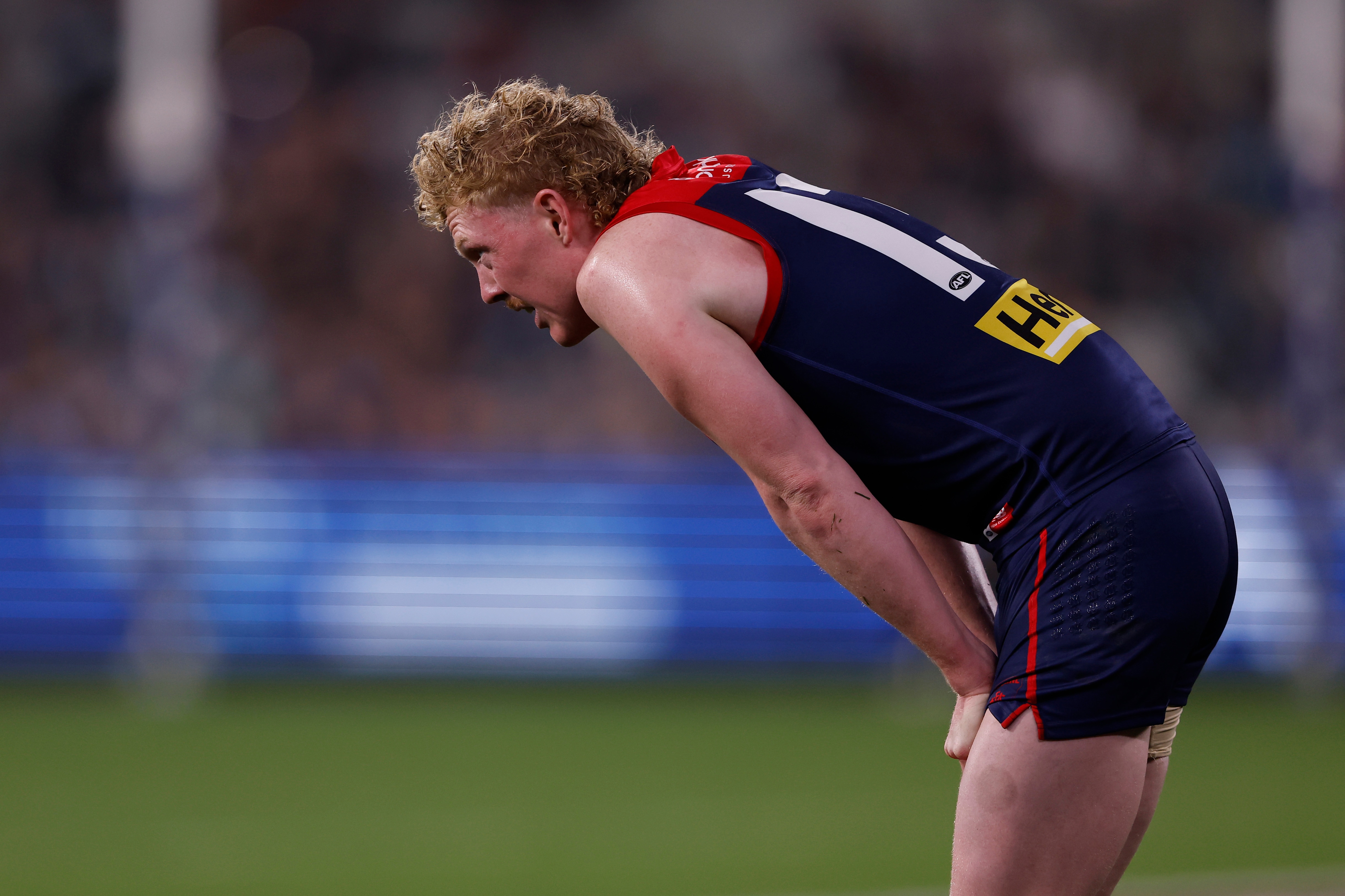 Goodwin says star pair will stay as surgery ends Oliver's season