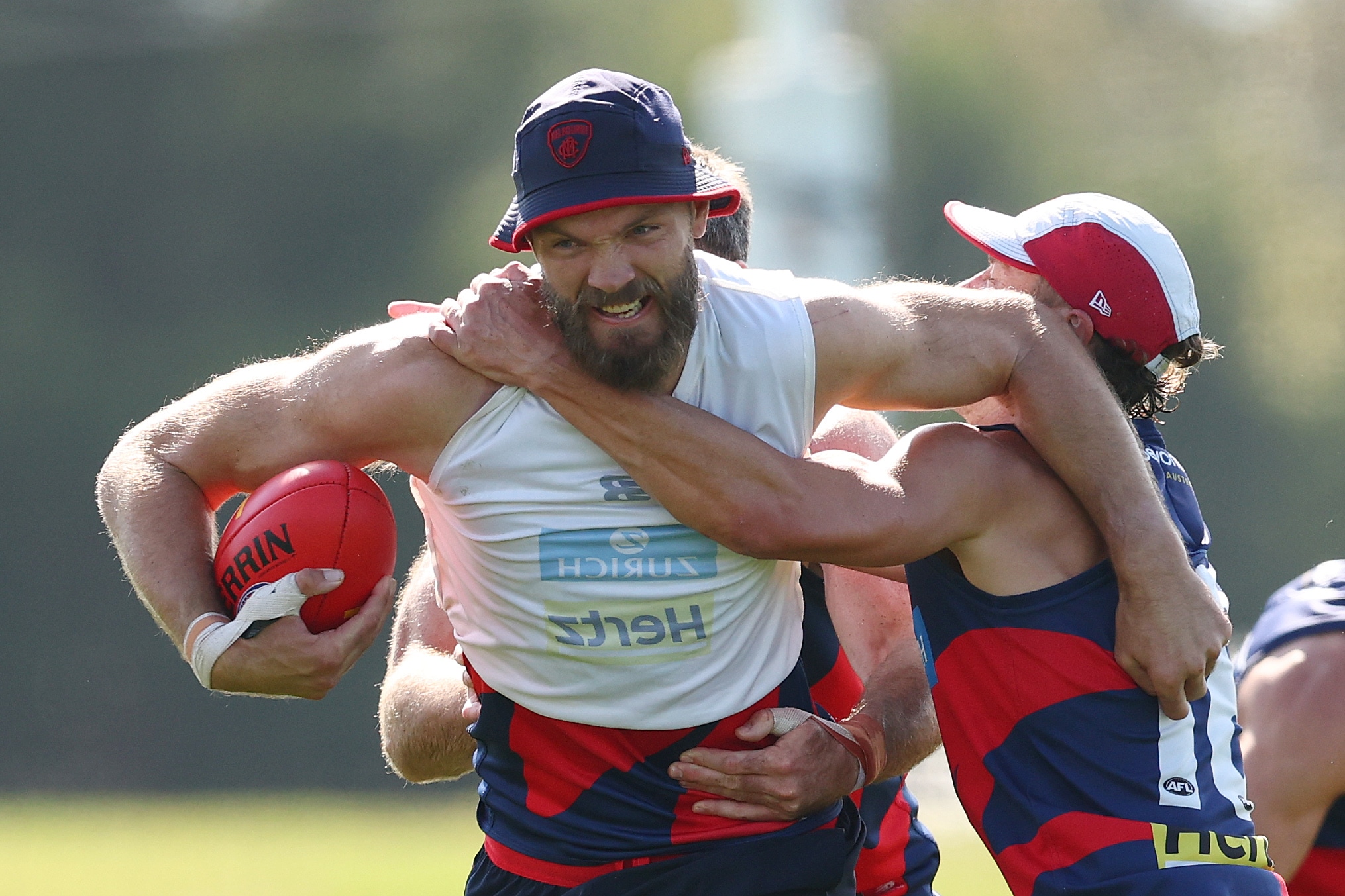 Demons skipper suffers fractured finger, veteran cops neck injury