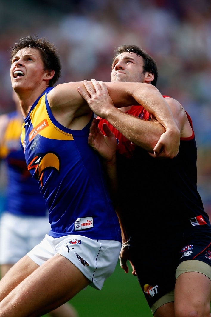 Compound Fractures In Sports