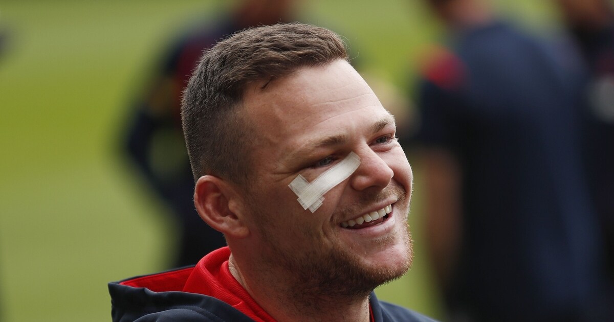 Melbourne star defender Steven May to return after nasty eye injury