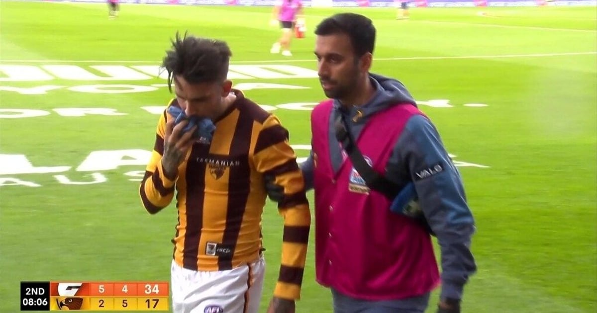 Gruesome injury for star Hawk