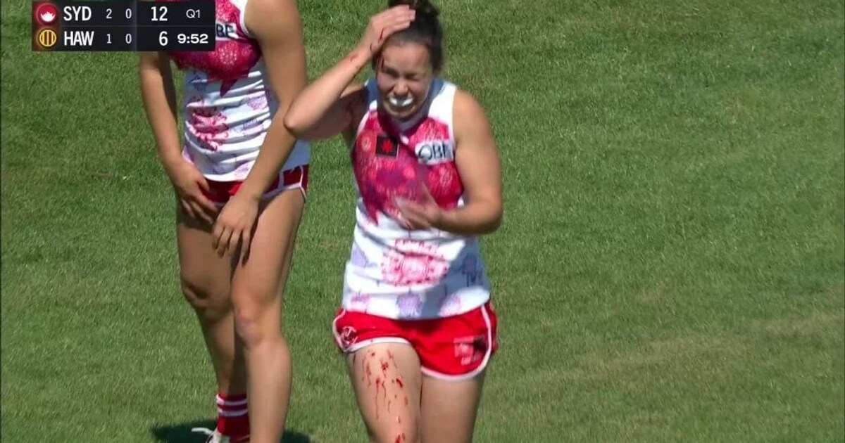 Double trouble as blood spills in brutal head clash